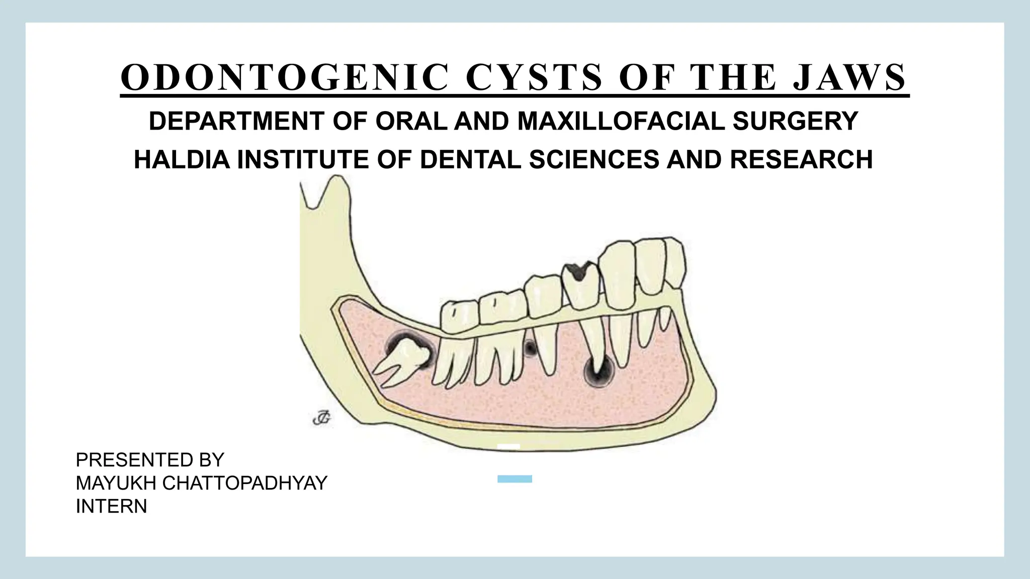 ODONTOGENIC CYSTS OF THE JAWS AND THE MANAGEMENT | PPTX