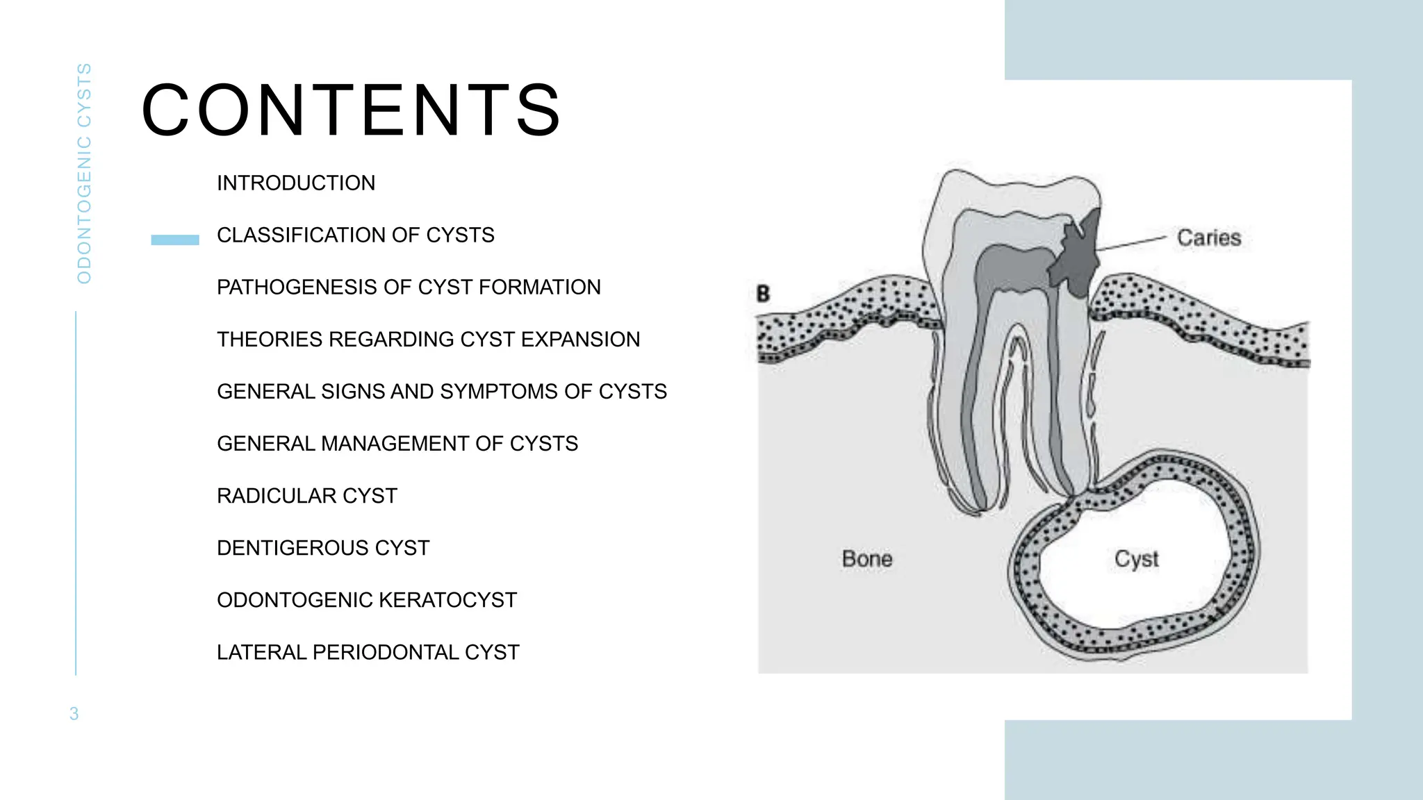 ODONTOGENIC CYSTS OF THE JAWS AND THE MANAGEMENT | PPTX