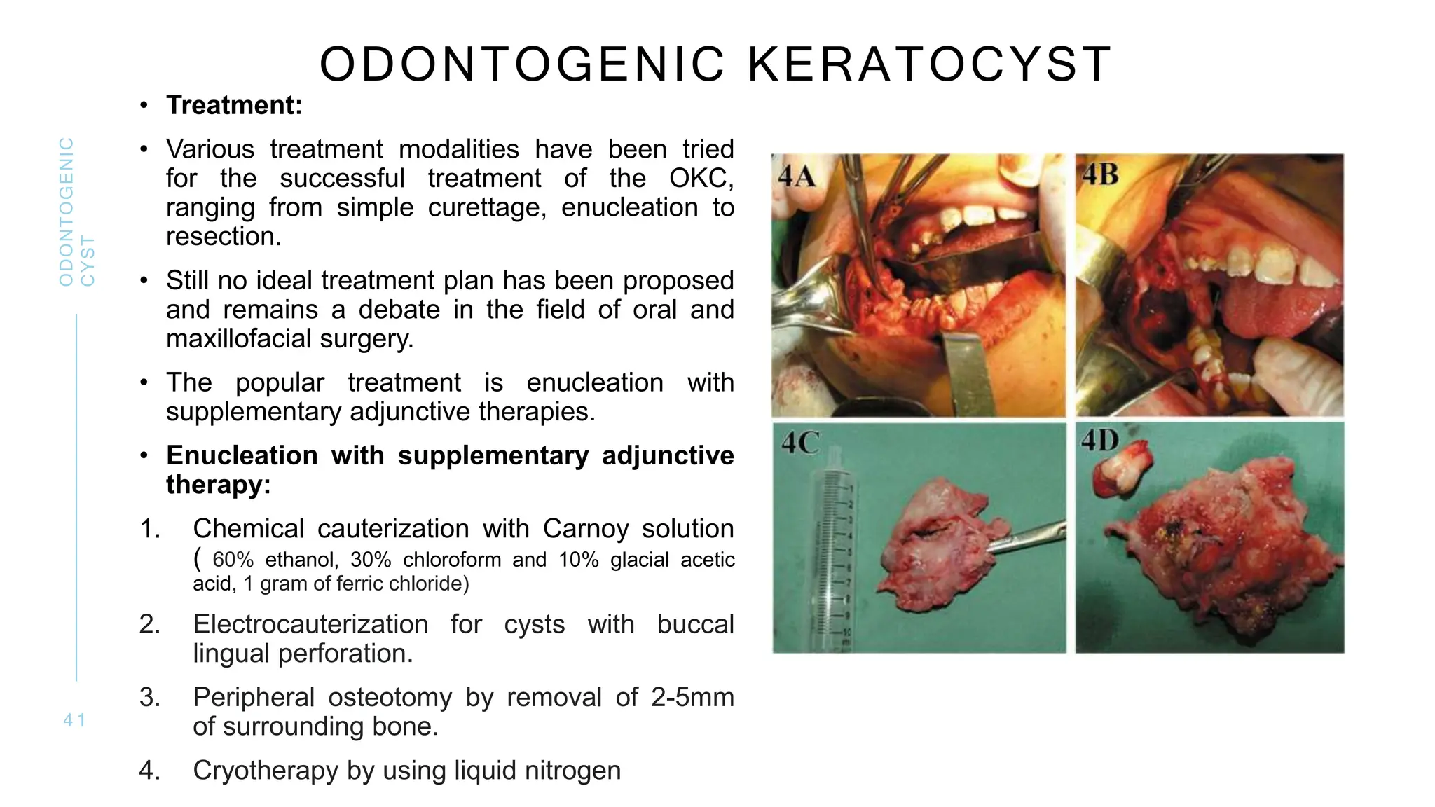 ODONTOGENIC CYSTS OF THE JAWS AND THE MANAGEMENT | PPTX