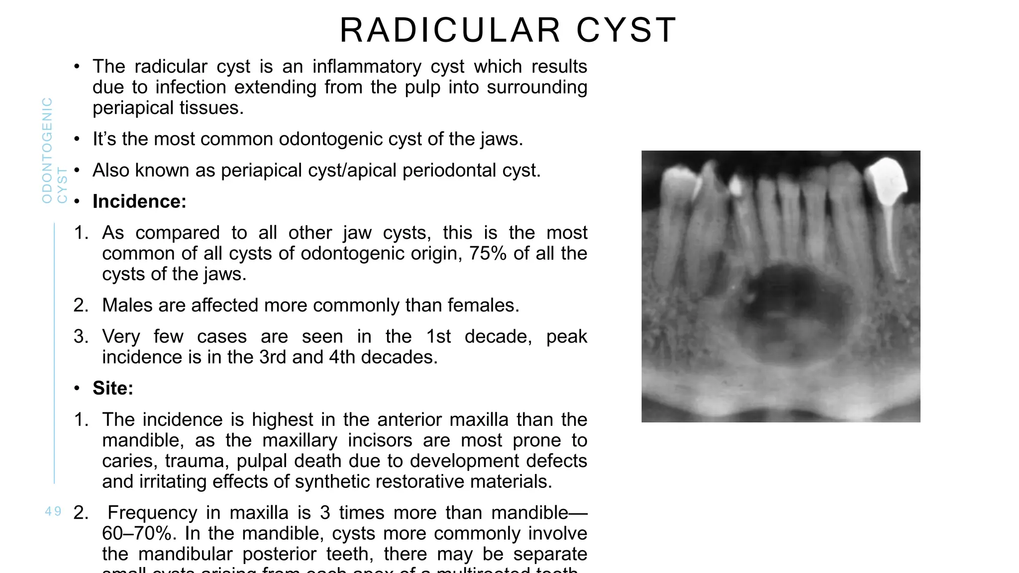 ODONTOGENIC CYSTS OF THE JAWS AND THE MANAGEMENT | PPTX