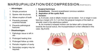 ODONTOGENIC CYSTS OF THE JAWS AND THE MANAGEMENT | PPTX