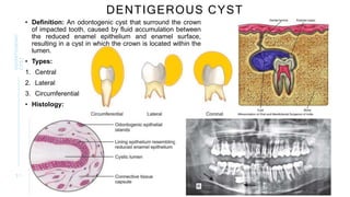 ODONTOGENIC CYSTS OF THE JAWS AND THE MANAGEMENT | PPTX