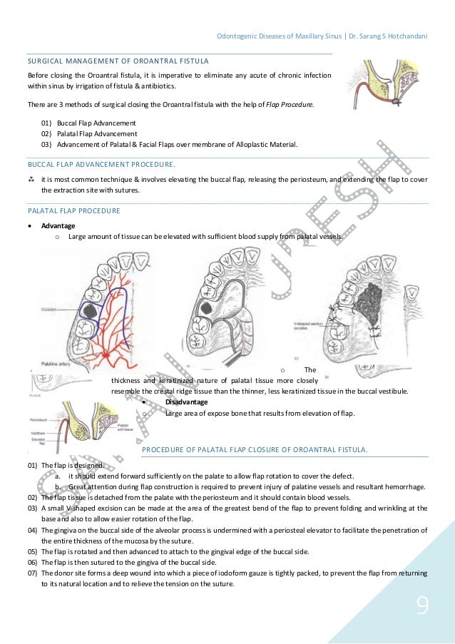 Odontogenic Disease of Maxillary Sinus (Study Notes: Oral & Maxillofa…
