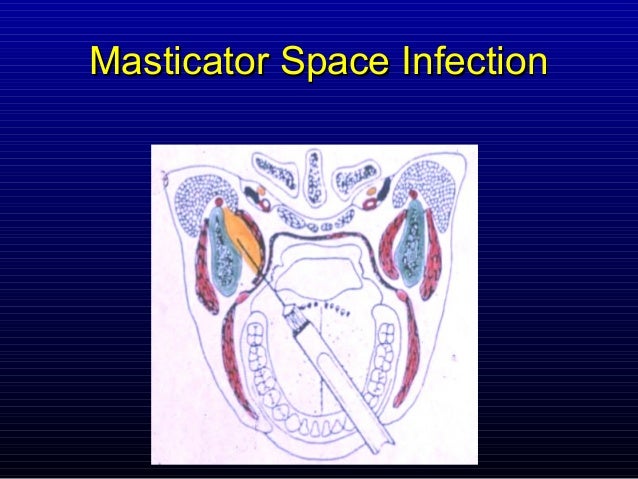 Masticator Space