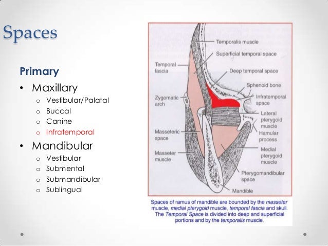 Odontogenic infections