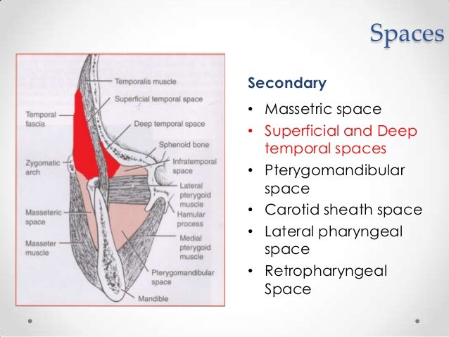 Odontogenic infections