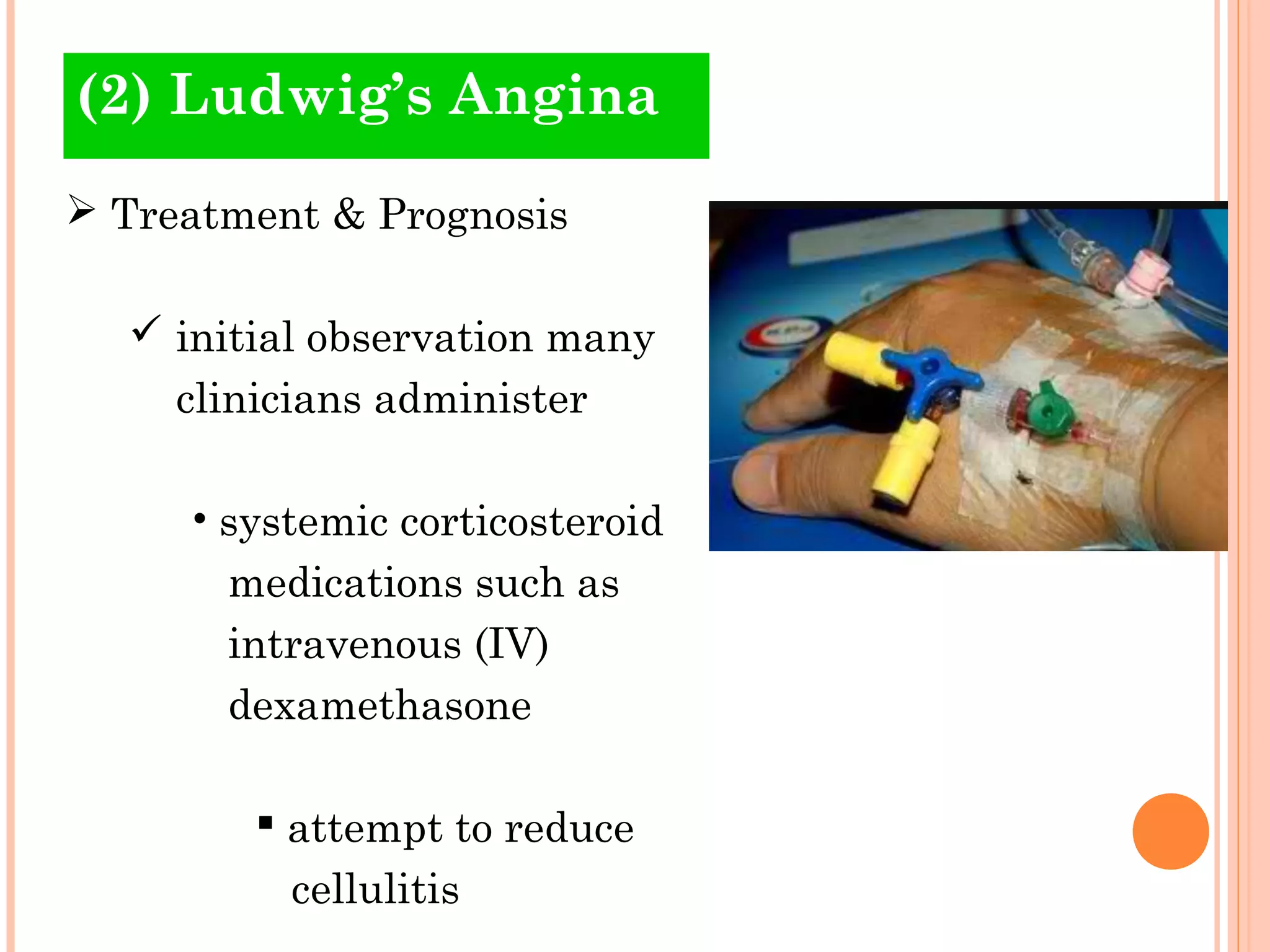 Odontogenic infections (4) | PPT