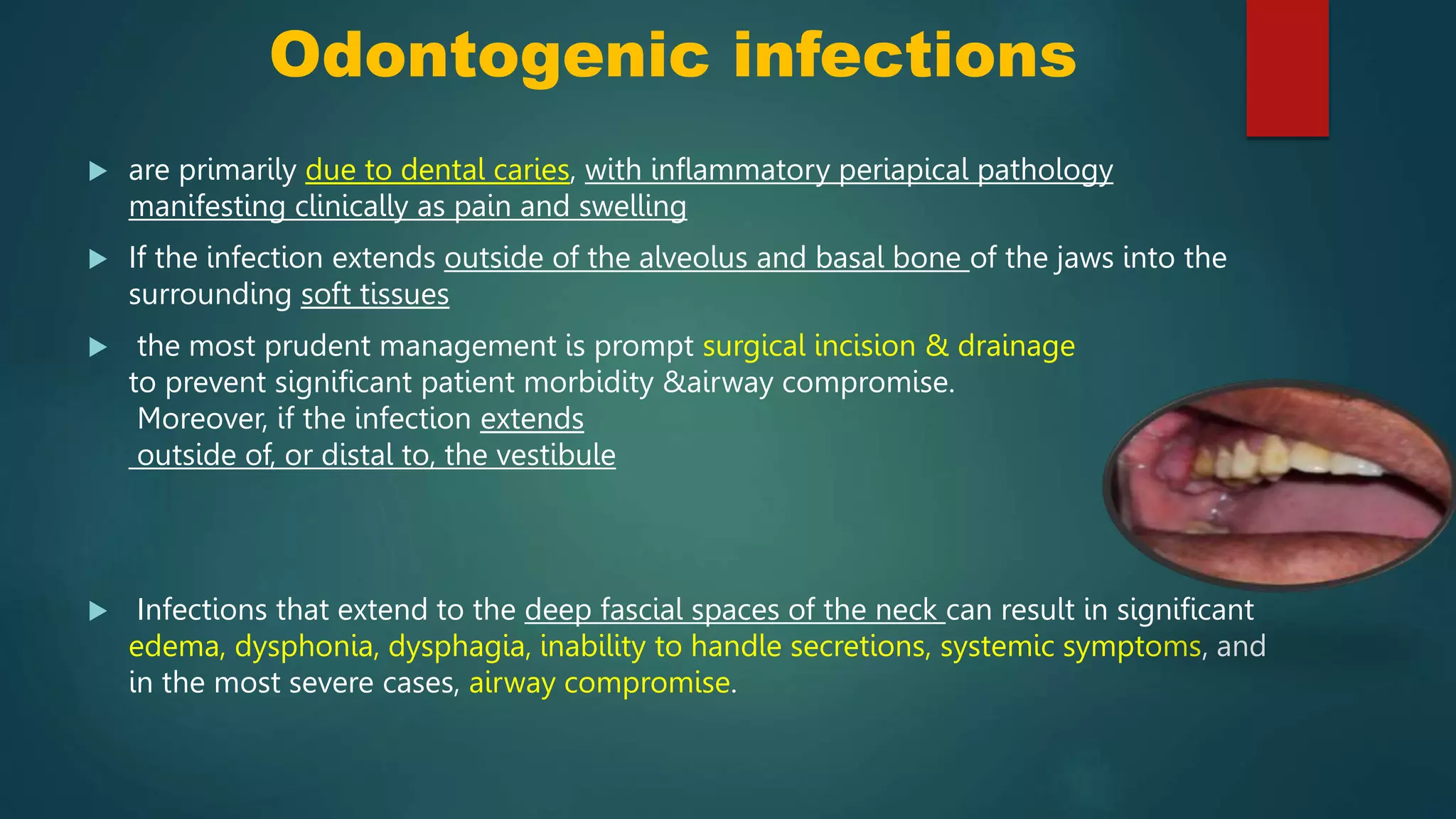 Odontogenic infections (fascial spaces).pptx