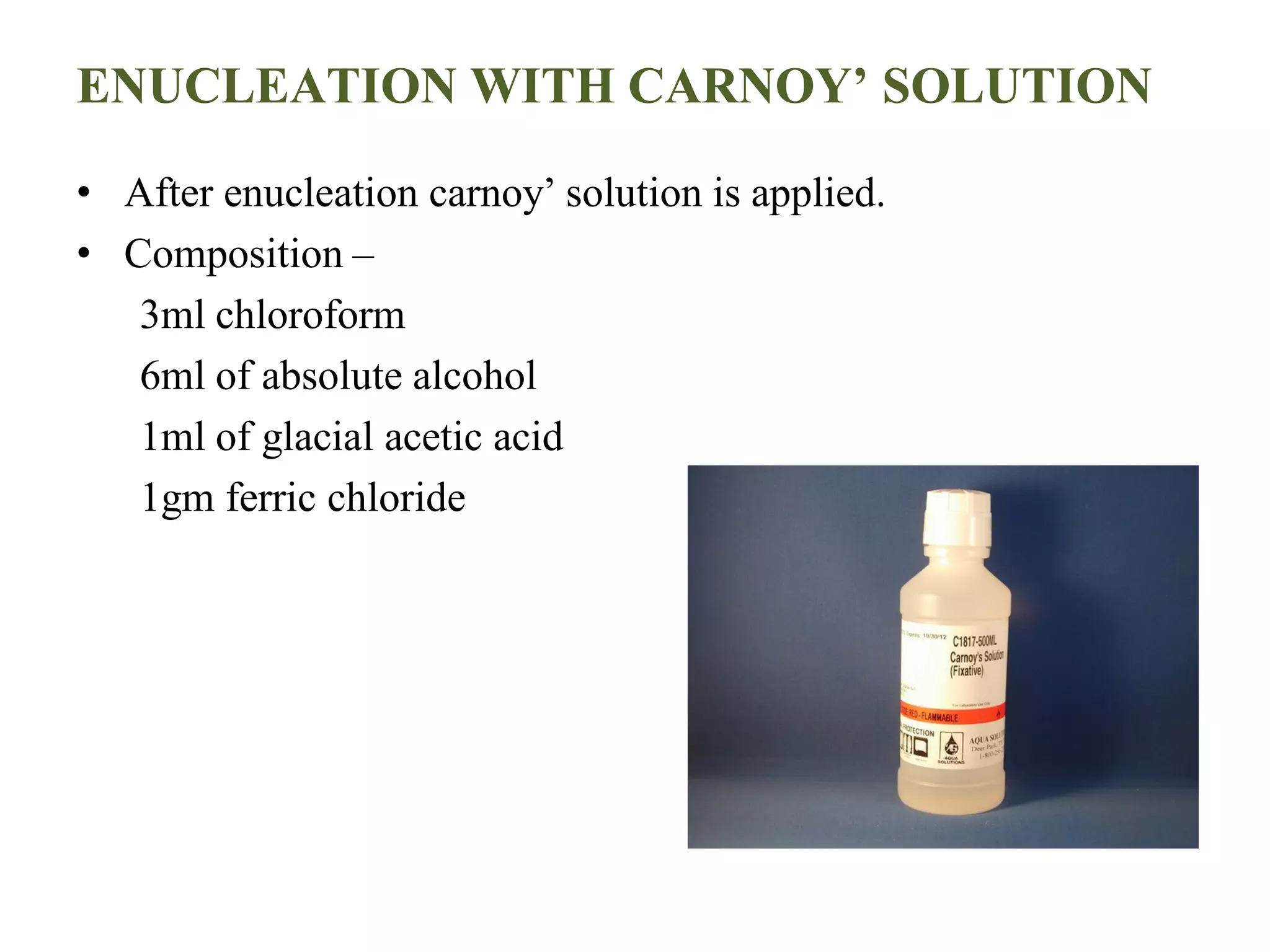 Odontogenic Keratocyst (OKC) | PDF