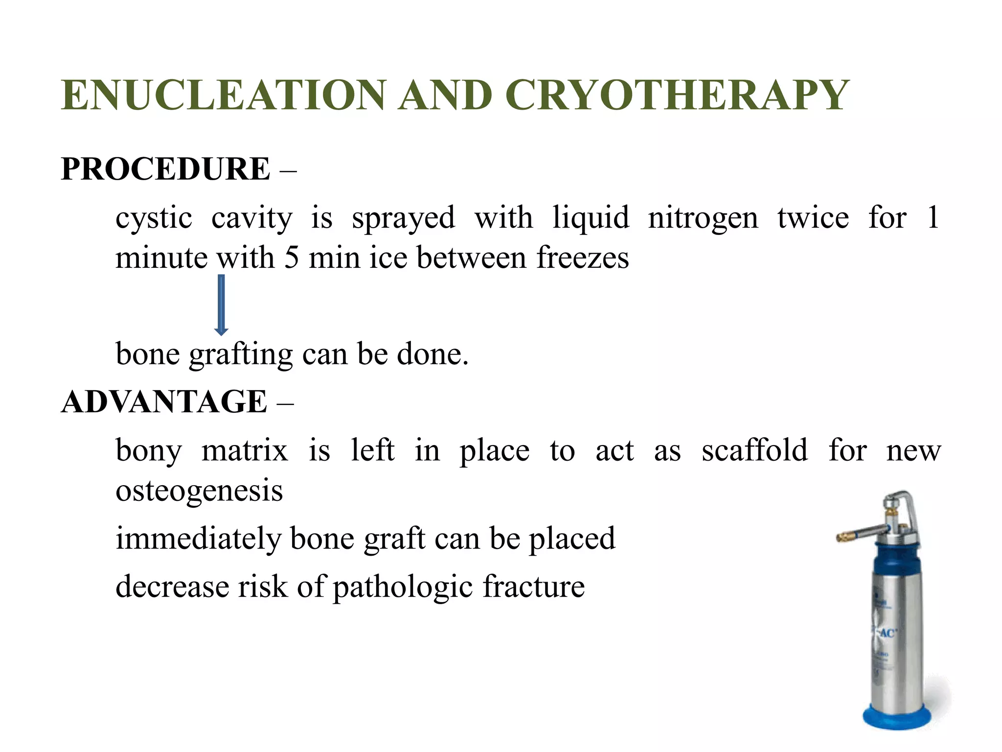 Odontogenic Keratocyst (OKC) | PDF