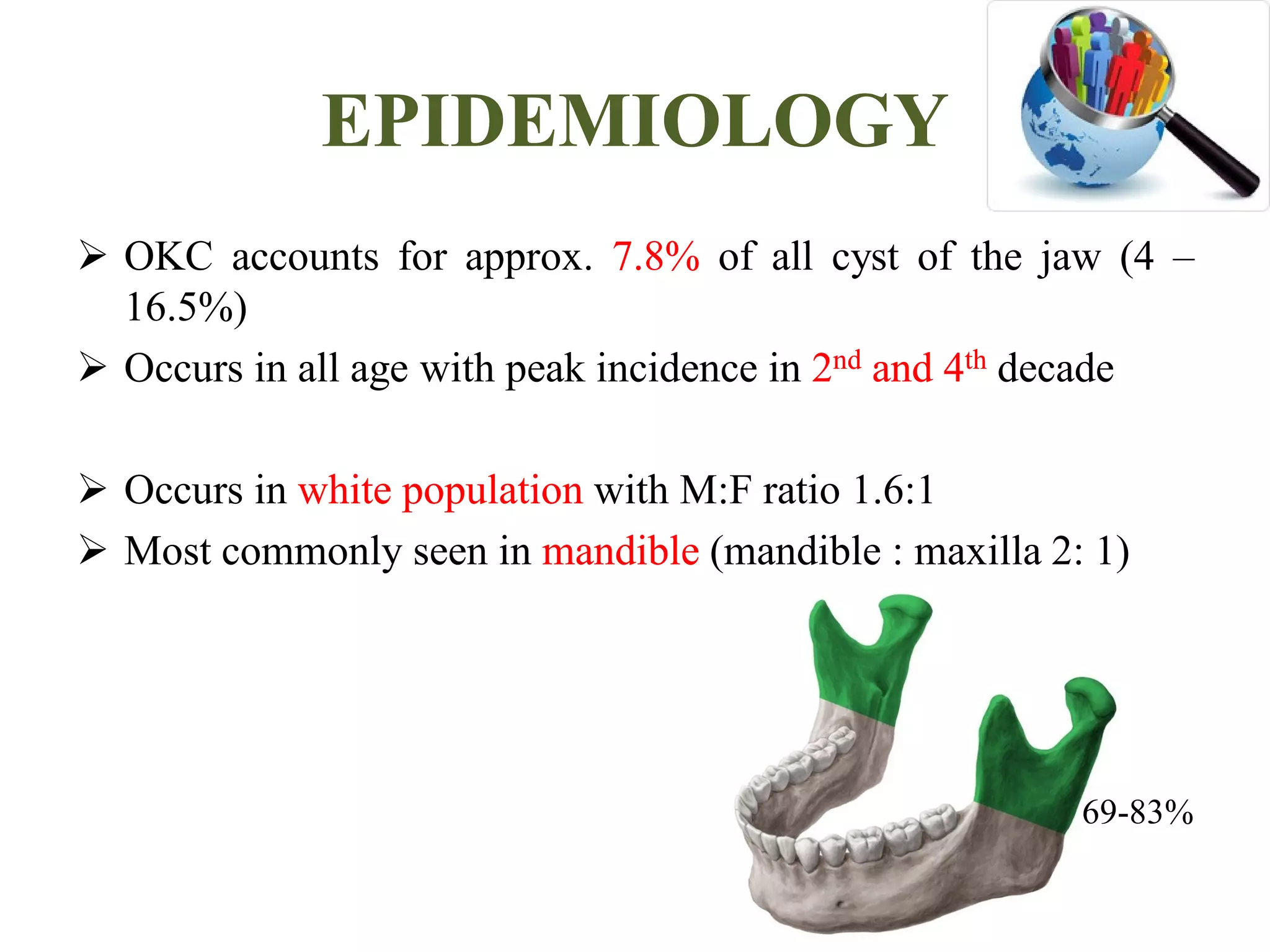 Odontogenic Keratocyst (OKC) | PDF
