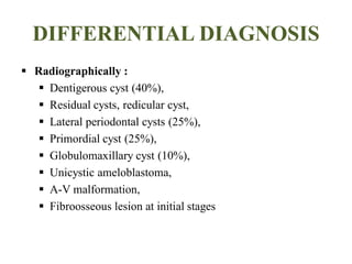 Odontogenic Keratocyst (OKC) | PDF