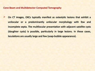Odontogenic Keratocyst: A Comprehensive Overview | PPTX