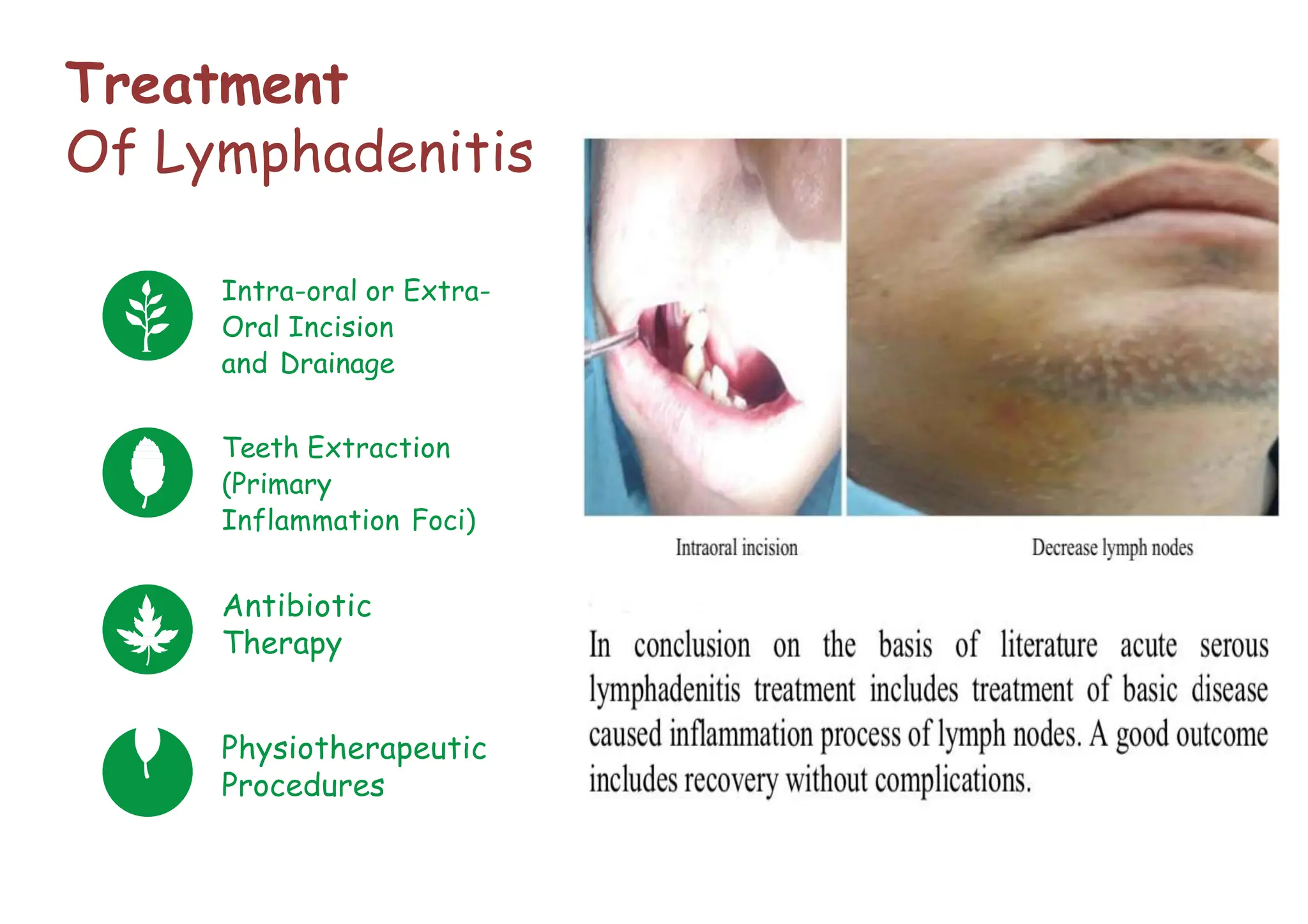 Odontogenic lymphadenitis and Adenophlegmon.pptx