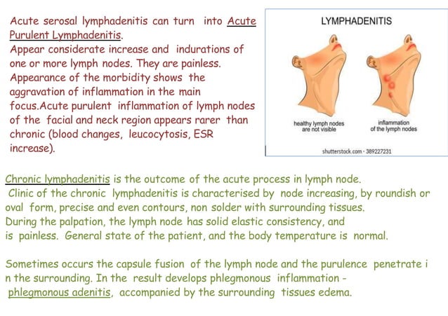 Odontogenic lymphadenitis and Adenophlegmon.pptx