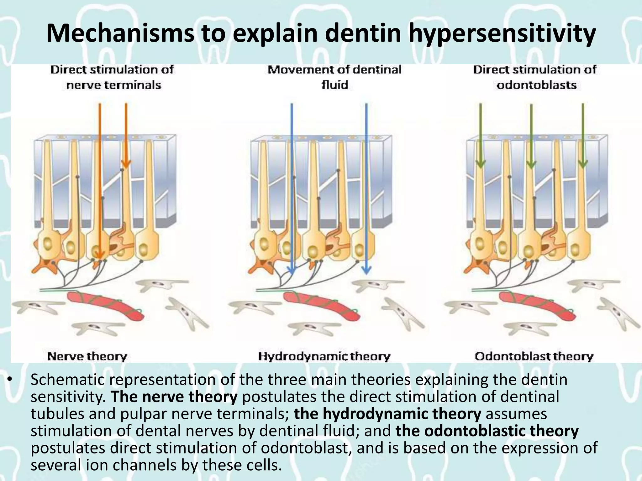 Odontogenic pain | PPTX