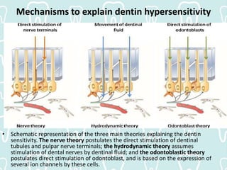 Odontogenic pain | PPT