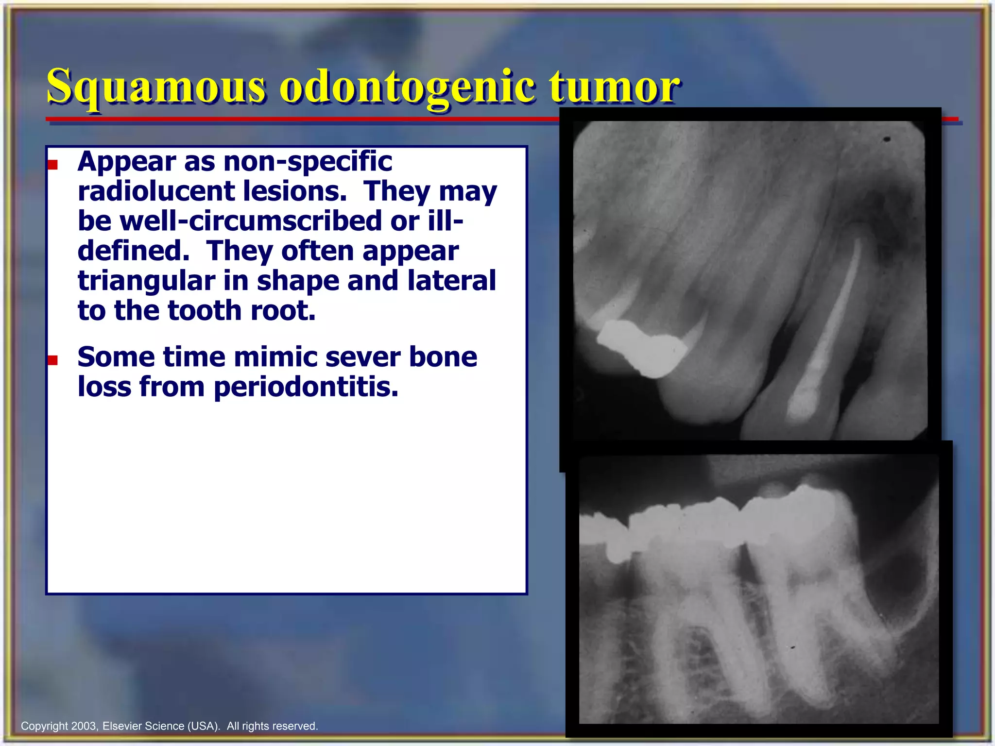 Odontogenic tumor | PPTX