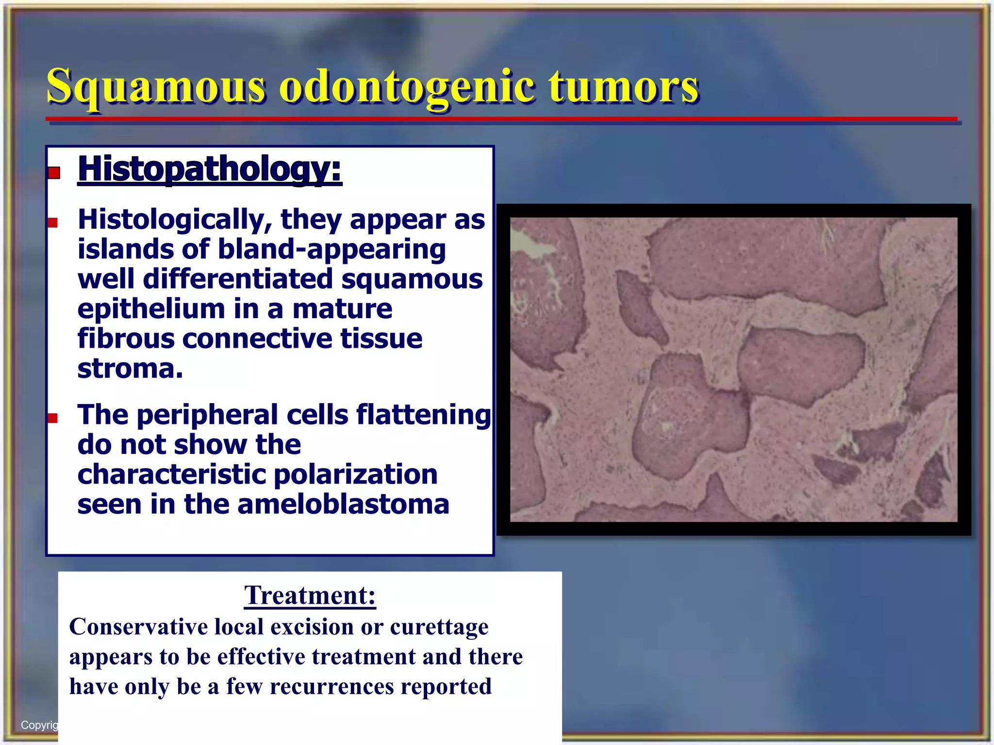 Odontogenic tumor | PPTX