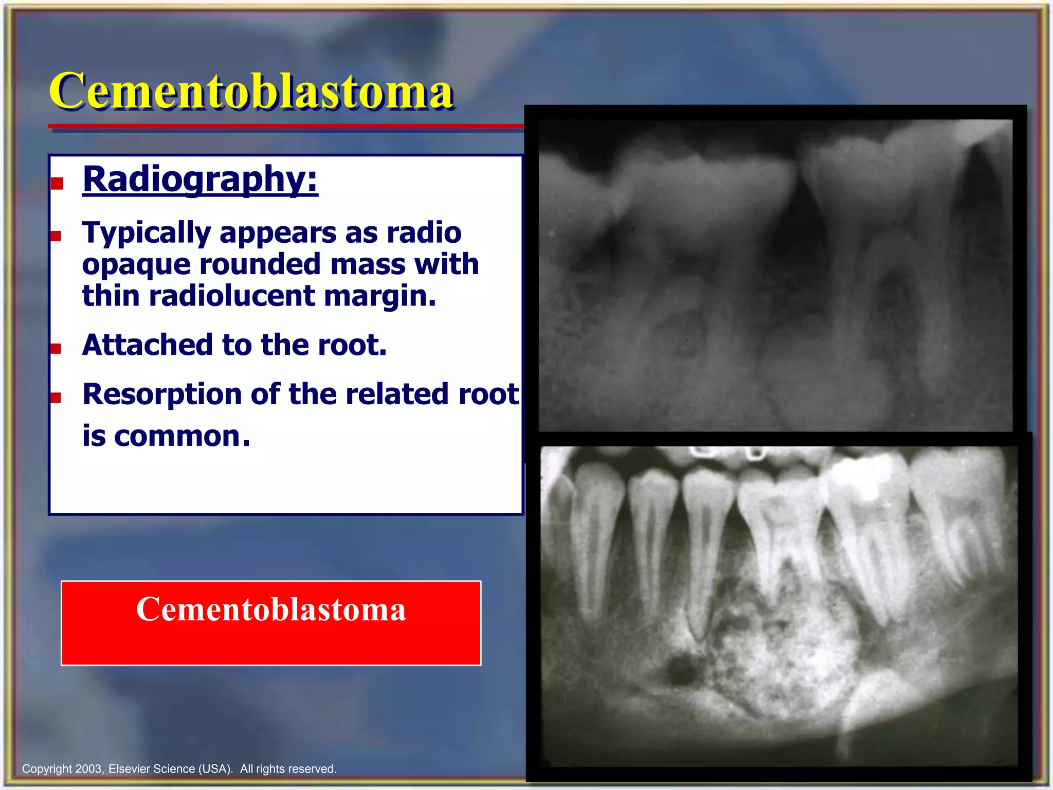 Odontogenic tumor | PPTX