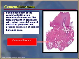 Odontogenic tumor | PPTX
