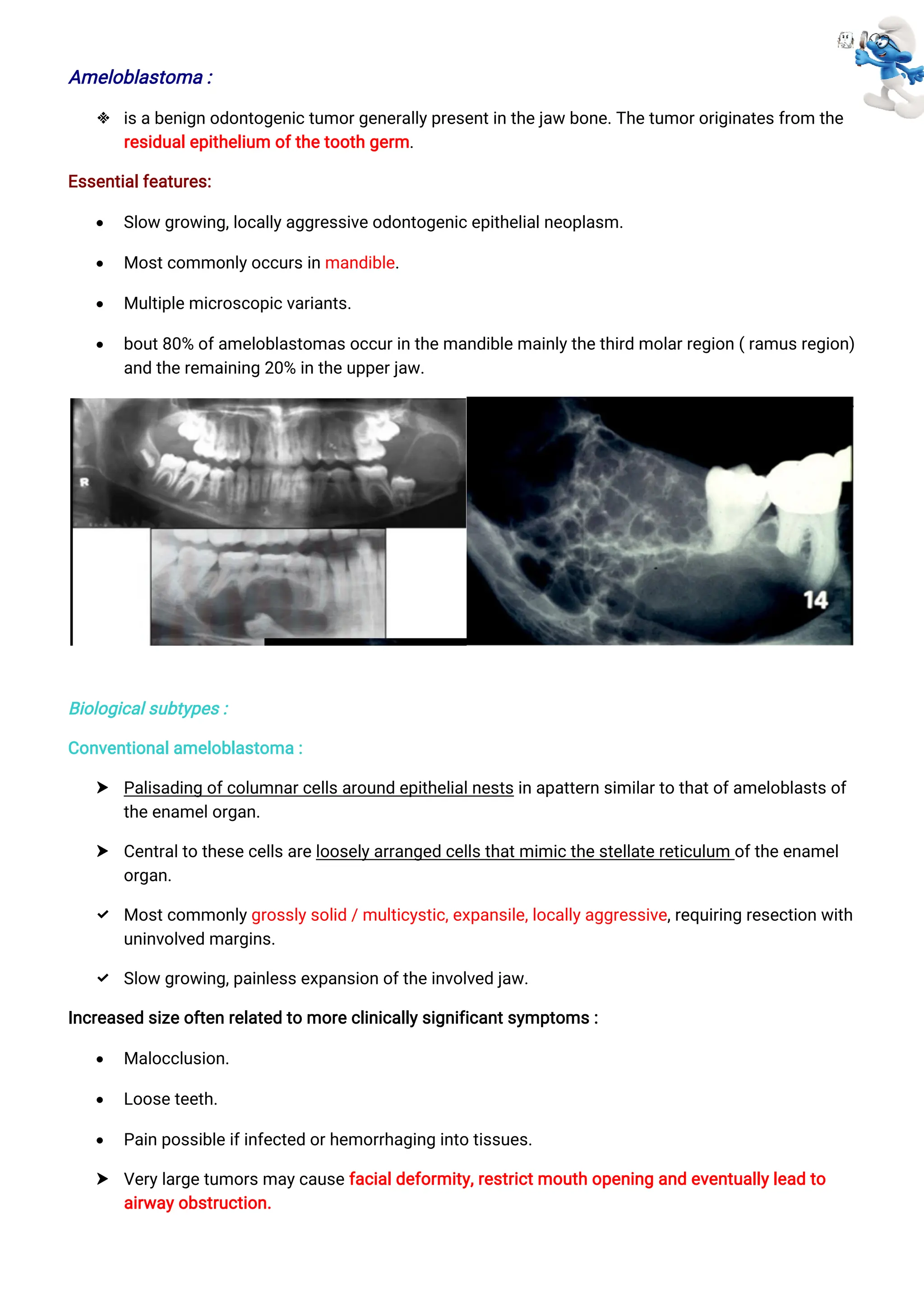 Odontogenic tumor ( Essential, Histologic, Radiographic features) | PDF