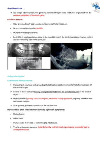Odontogenic tumor ( Essential, Histologic, Radiographic features) | PDF ...
