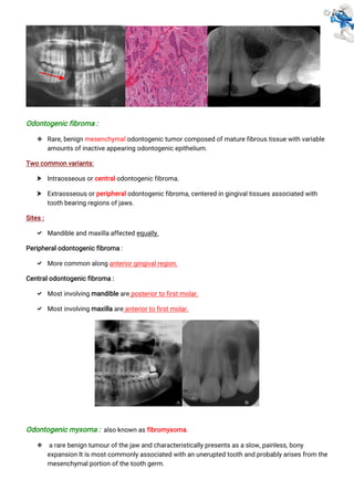 Odontogenic tumor ( Essential, Histologic, Radiographic features) | PDF ...