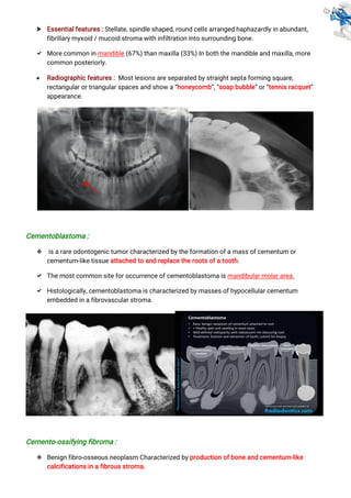 Odontogenic tumor ( Essential, Histologic, Radiographic features) | PDF ...