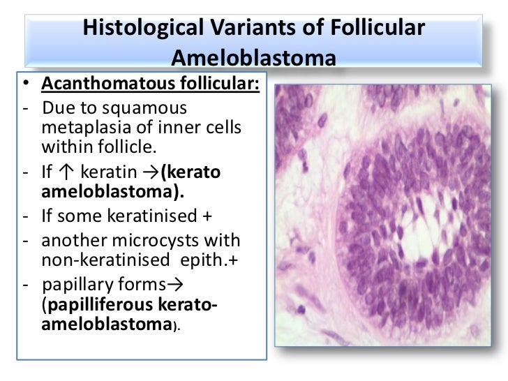 Odontogenic tumors