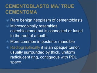 Odontogenic tumors | PPTX