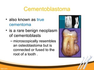 Odontogenic tumors- By Romeo Papa | PPT