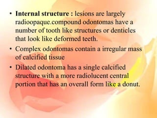 ODONTOGENIC TUMORS.pptx