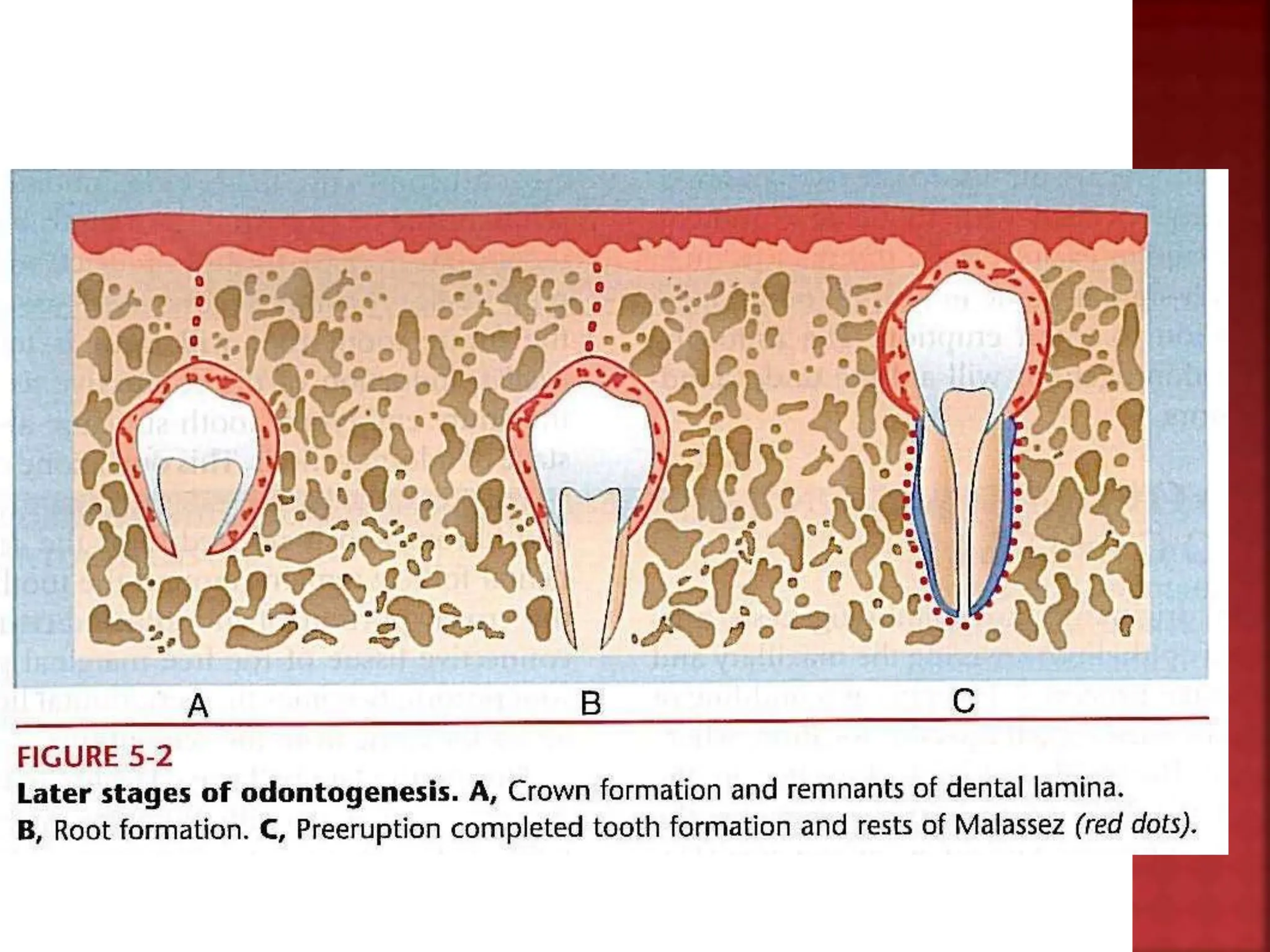 odontogenic tumors lecture presentation.pptx