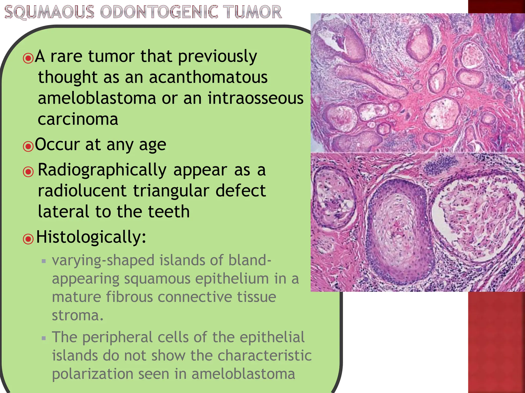 odontogenic tumors lecture presentation.pptx