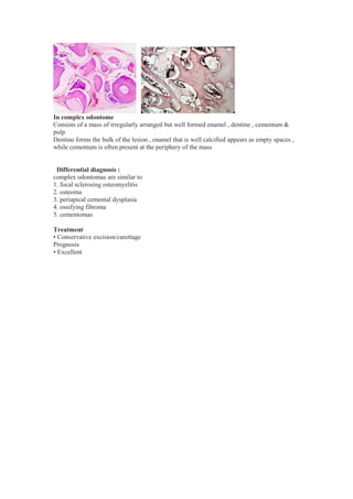 Odontogenic tumors iii | PDF