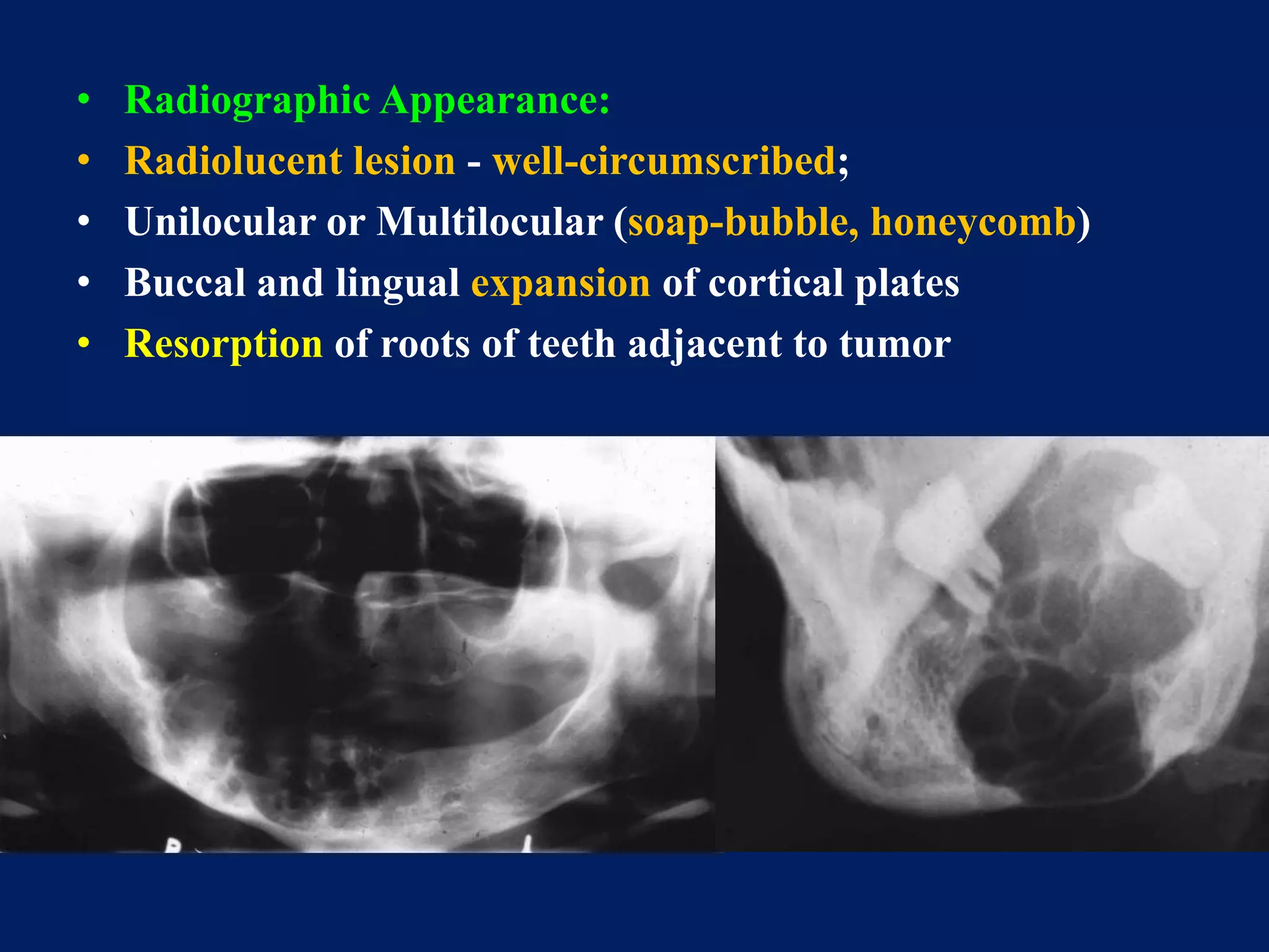 Odontogenic tumors ppt | PPTX