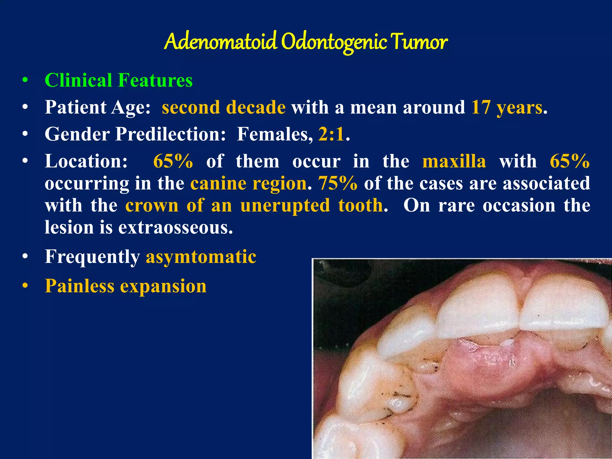 Odontogenic tumors ppt | PPTX