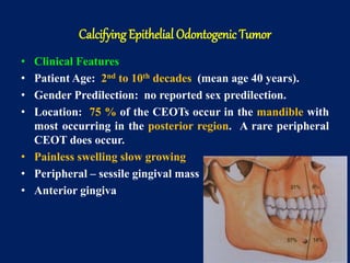 Odontogenic tumors ppt | PPTX