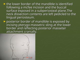 ODONTOGENIC TUMORS OF ORAL CAVITY.pptxxx | PPT