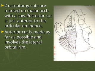 ODONTOGENIC TUMORS OF ORAL CAVITY.pptxxx | PPT