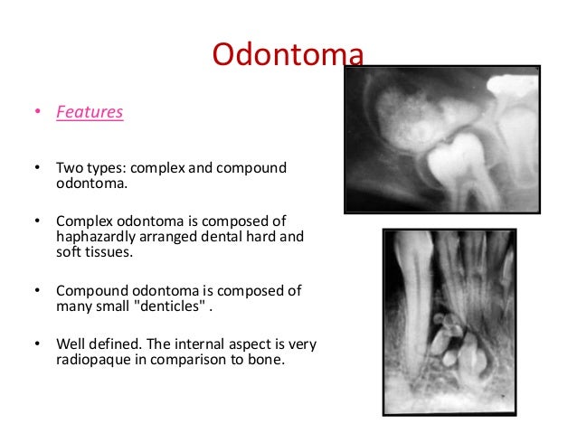 Odontogenic tumours