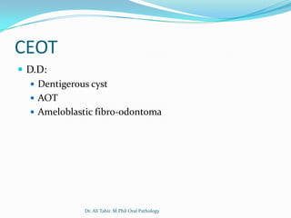 Odontogenic tumours part 2 | PPTX