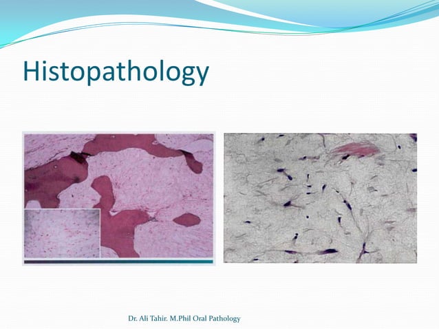 Odontogenic tumours part 3 | PPTX