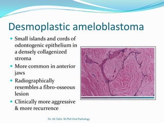 Desmoplastic Ameloblastoma Histology