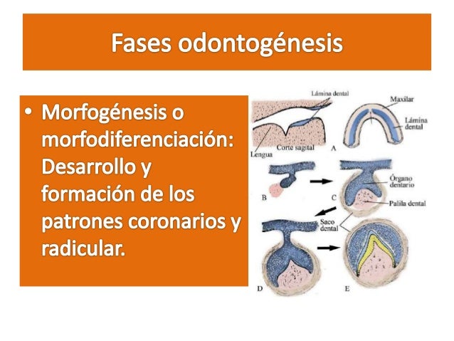Odontogénesis