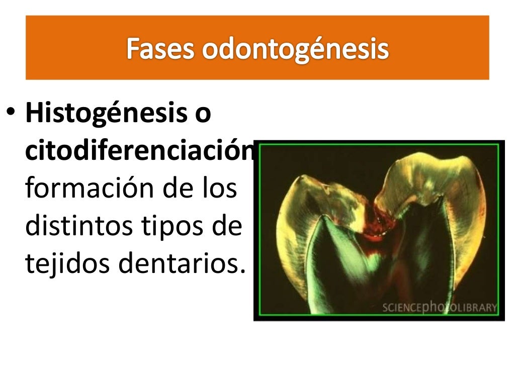 Odontogénesis
