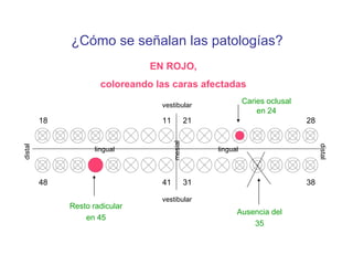 Odontograma | PPT