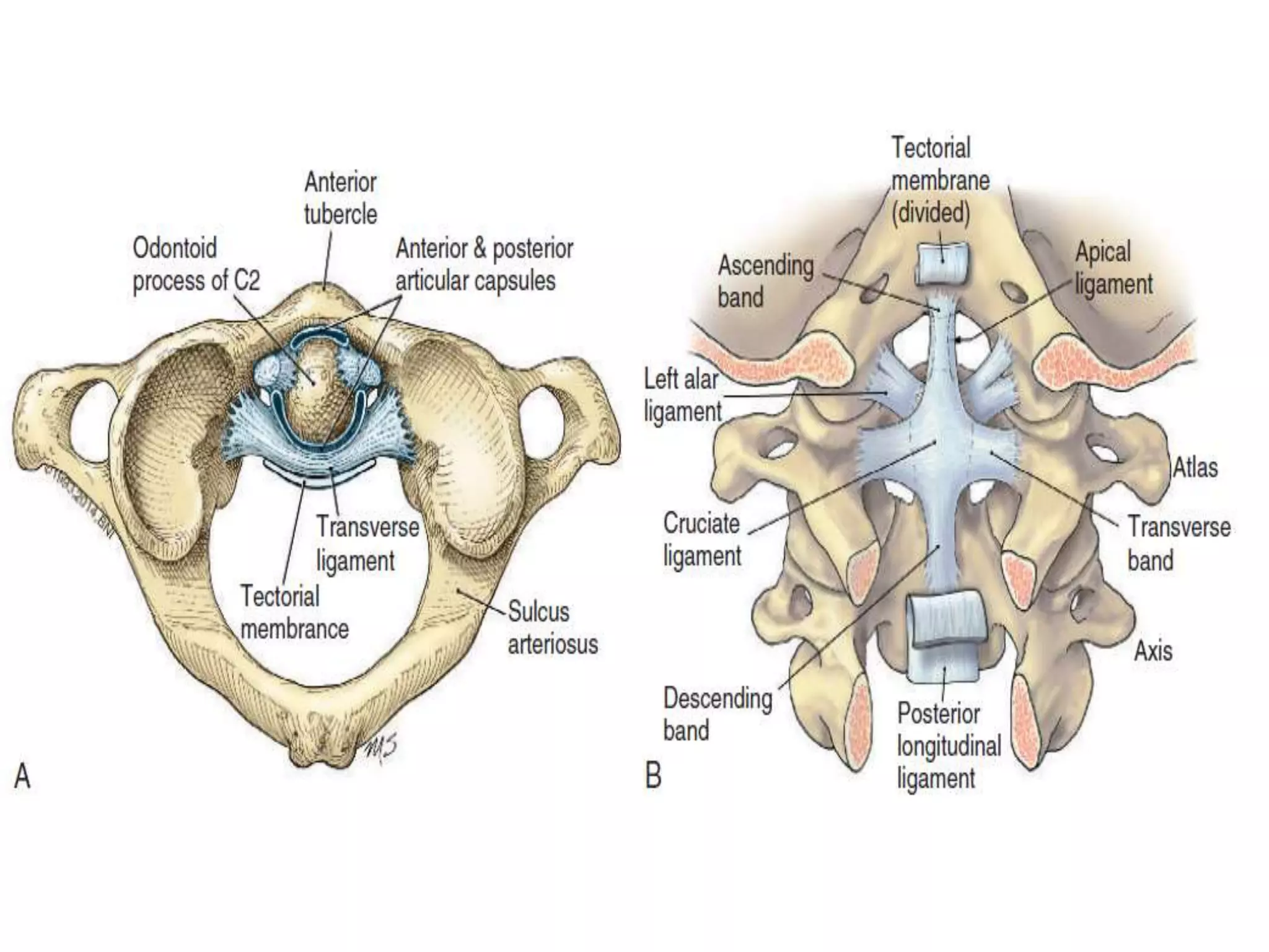 Odontoid and hangman fracture | PPTX