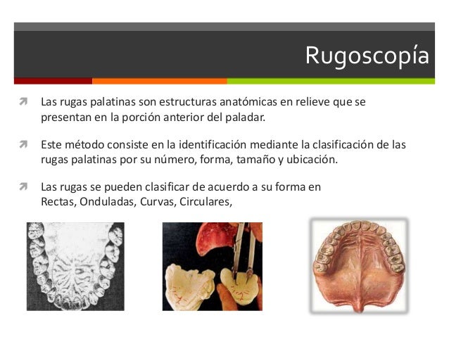Odontología Forense